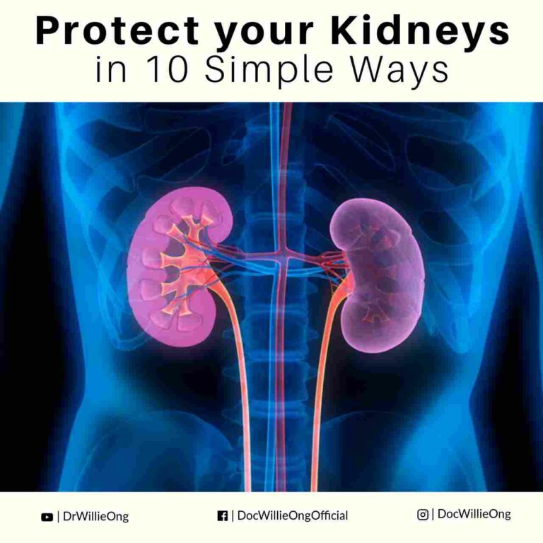 Protect Your Kidneys In Ten Simple Ways - Doc Willie Ong