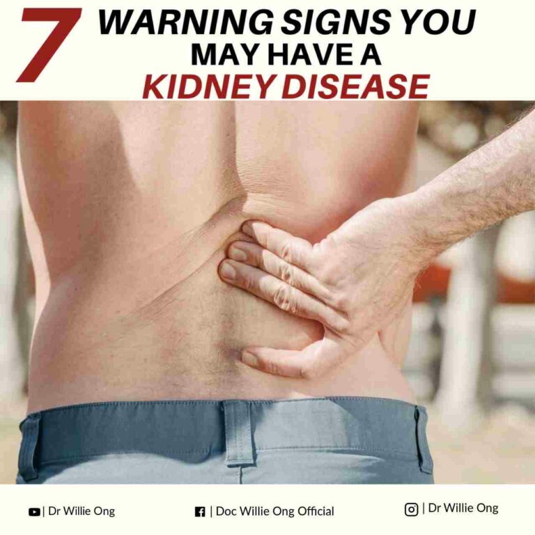 7 Warning Signs You May Have Kidney Disease - Doc Willie Ong